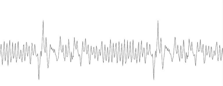 Impact monitoring for reciprocating compressors — Istec